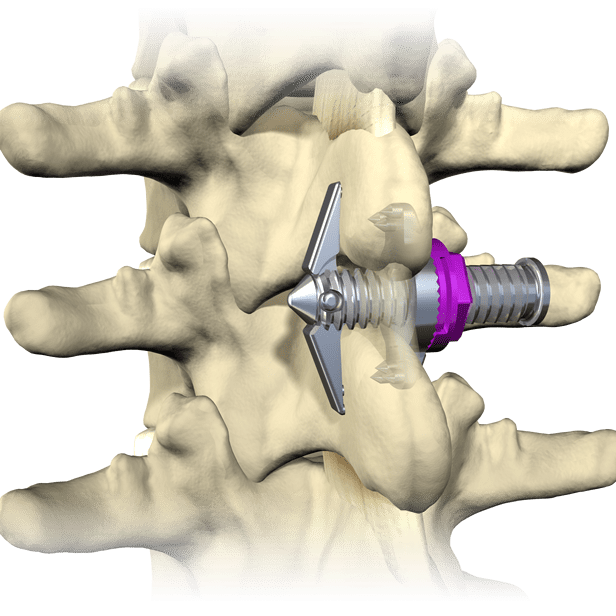 Back & Spine Specialists | The Specialty Clinic of Southern Oklahoma ...