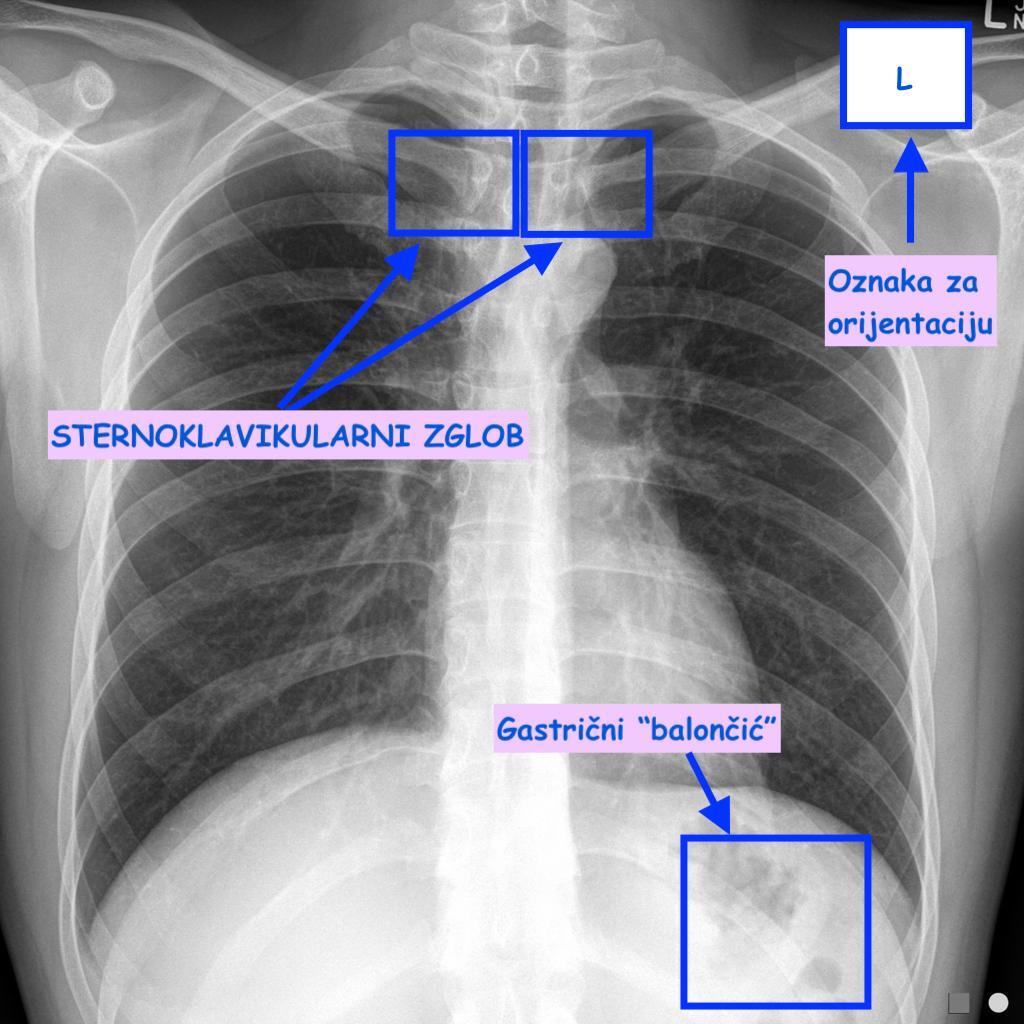 INTERPRETACIJA RTG P/C