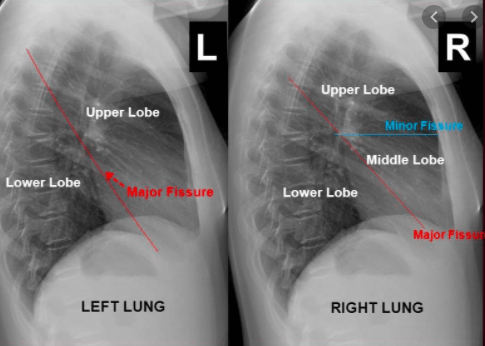 RENTGENANATOMIJA PLUĆA, SRCA I KRVNIH SUDOVA