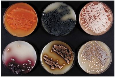 Global Indoor Health Network - Streptomyces