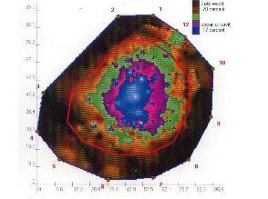 Picus Sonic Tomographs in Sydney | Australian Tree Consultants Pty Ltd