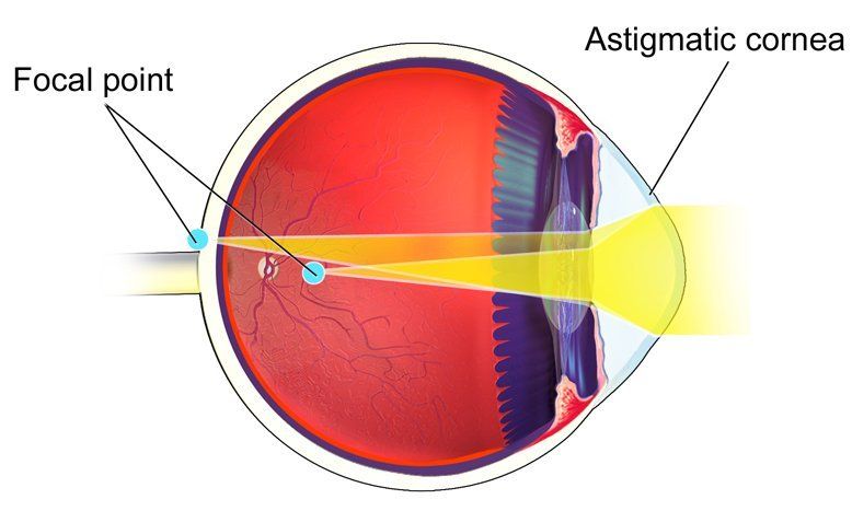 Susquehanna Eye Associates