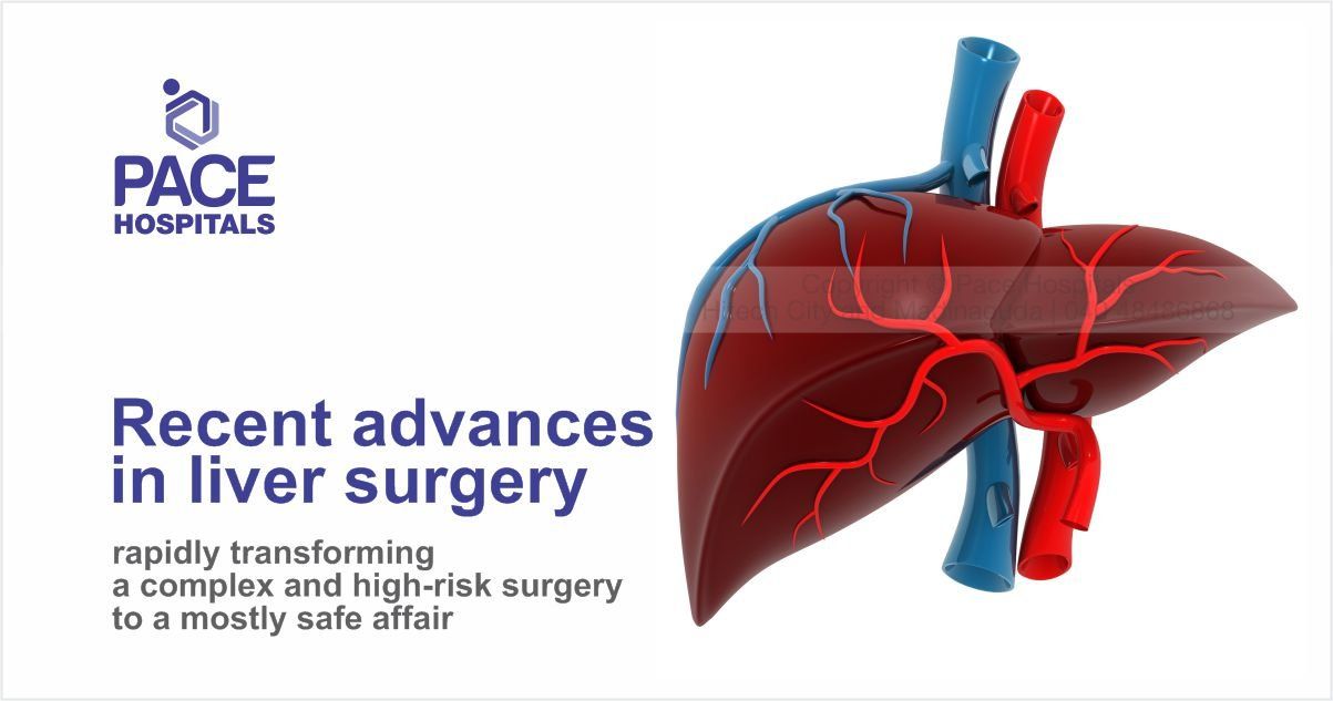 Right hepatectomy with ductoplasty and hepaticojejunostomy
