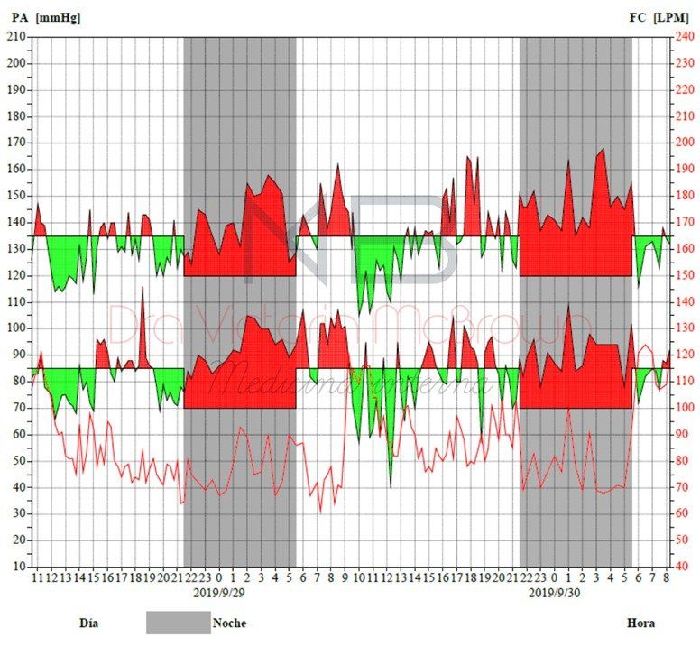 Monitoreo ambulatorio de presion arterial o MAPA