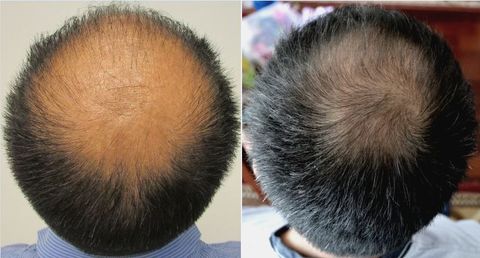 Real hair growth client success stories and reviews