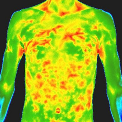 Body Imaging | Nashville, TN | Sozo Thermography