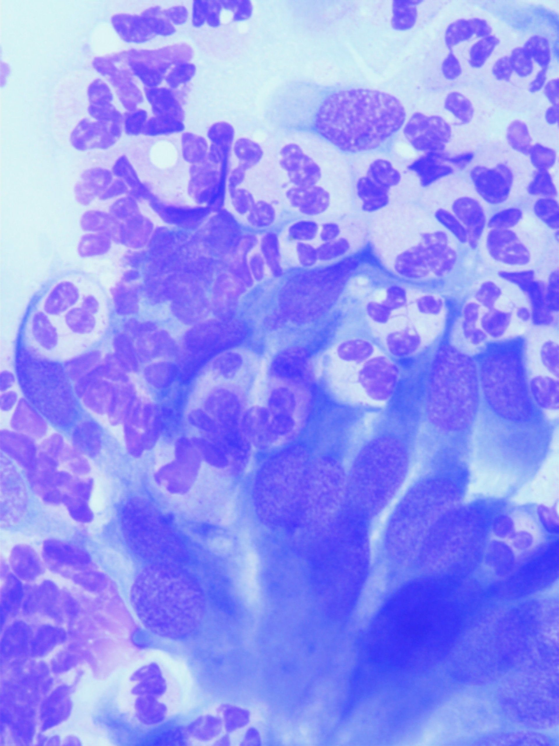 Cura dermatiti contatto - Bari - Manfredi Dr. Giacomo