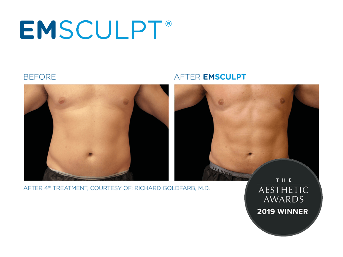 EMSCULPT Updates