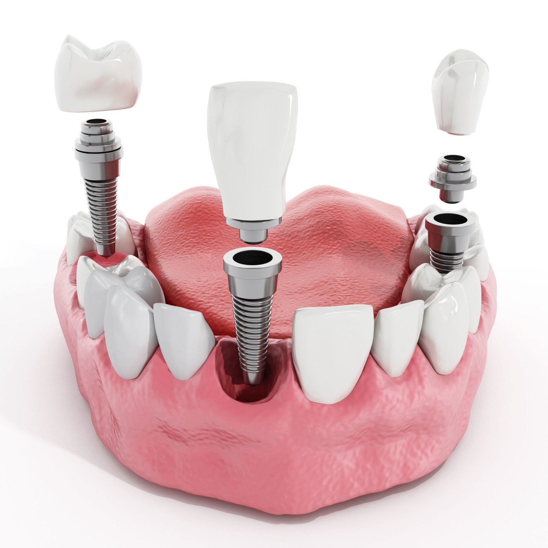 Pakalpojumi | Zobārstniecība "Dental Guru"
