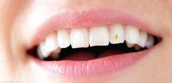 Zahnschmuck Bochum, Zahnarztpraxis Stoltenberg