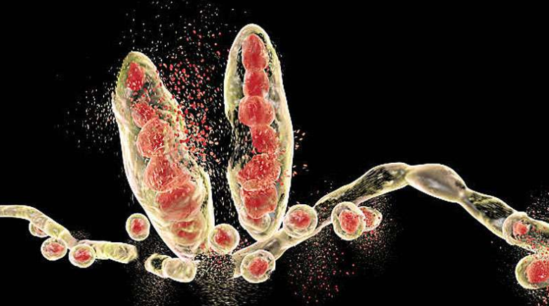 TIÑA CAPITIS, LA PELIGROSA INFECCIÓN POR HONGOS QUE PRODUCE CALVAS O SE ...