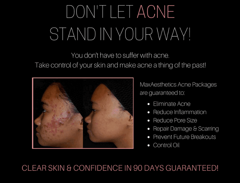 Home|Skincare Spa Treatments For Acne,Skin Lightening & facials ...