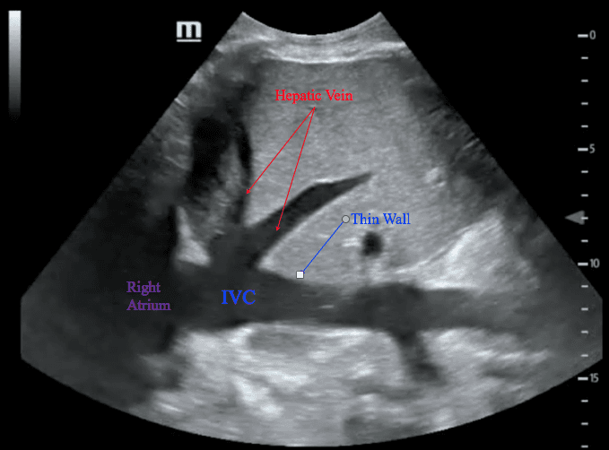 Internal Medicine Point of Care Ultrasound - IMPoCUS