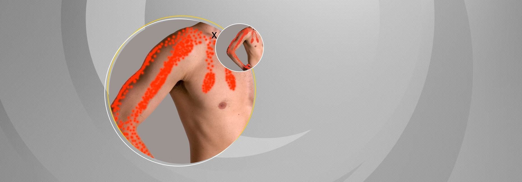 Trigger Point Release Therapy | Management of Pain | Lincoln, NE