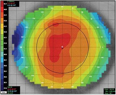 Eye Exam - Hansen Optometrists - Eyecare Plus
