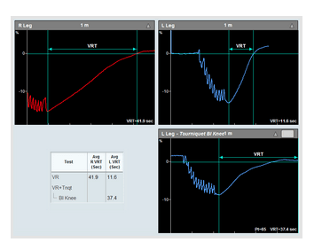 Viasonix Falcon Pro | Peripheral Vascular Diagnostic System | IMI USA