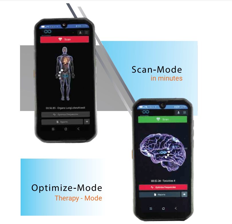 Solex Nation AO Body Scan